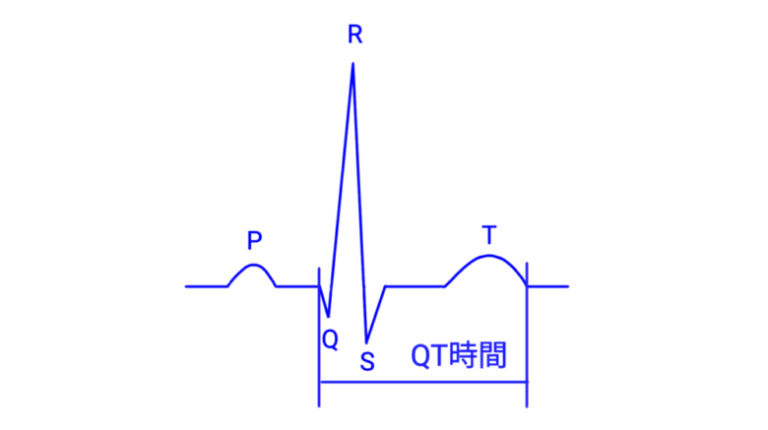 心電図をわかりやすく説明 ⑬QT時間 TdP U波 | 医師の心電図ブログ