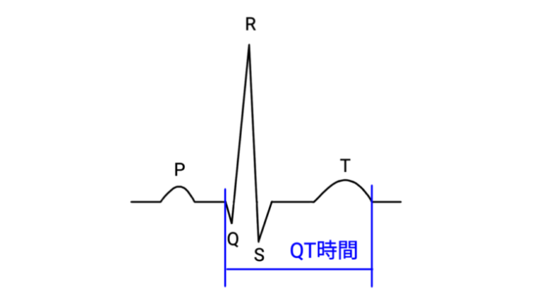 心電図をわかりやすく説明 ⑬QT時間 TdP U波 | 医師の心電図ブログ